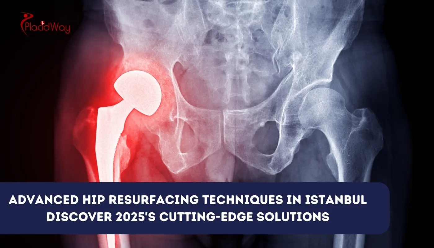 Advanced Hip Resurfacing Techniques in Istanbul Turkey - 2025